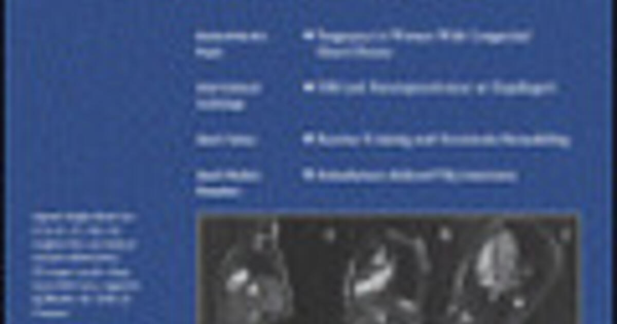 ACC/AHA Guidelines for Implantation of Cardiac Pacemakers and ...